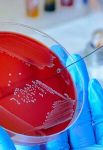 Cannabis Microbial Testing | Nova Analytic Labs